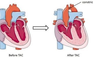 Transverse Aortic Constriction Archives - Scintica Instrumentation